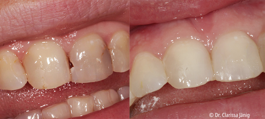 How Medical and Cosmetic Tooth Whitening can be Life-Changing: Using ...