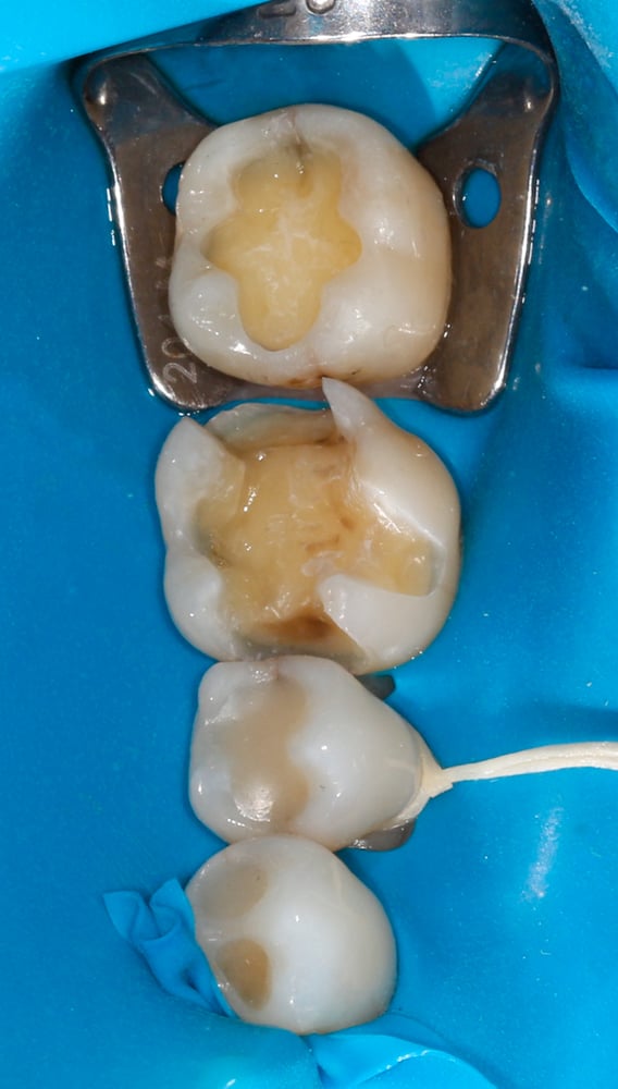 Esthetics with Simplicity: How New Technologies Can Help Us with ...