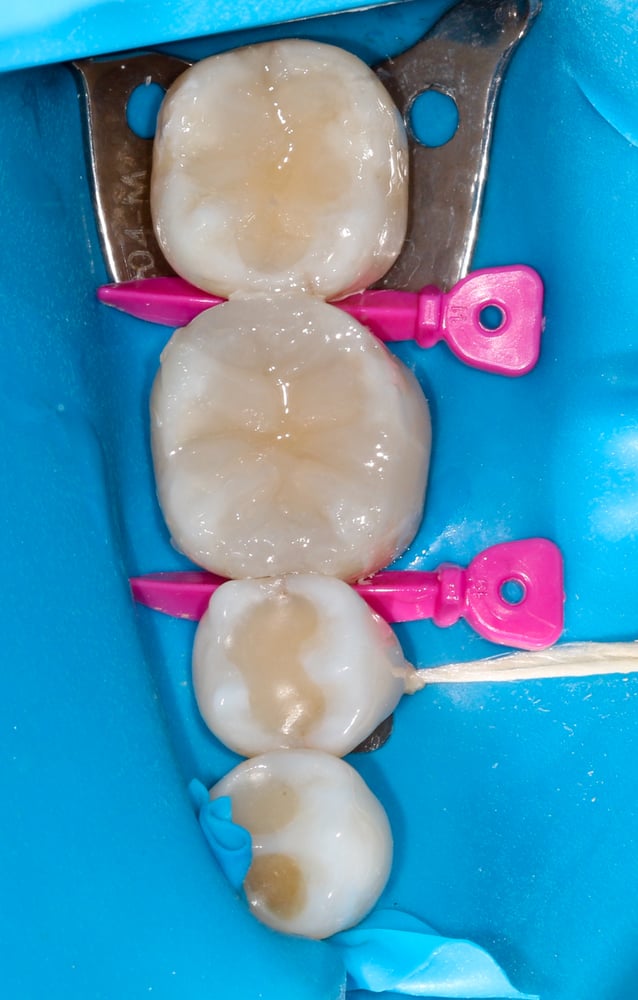 Esthetics with Simplicity: How New Technologies Can Help Us with ...
