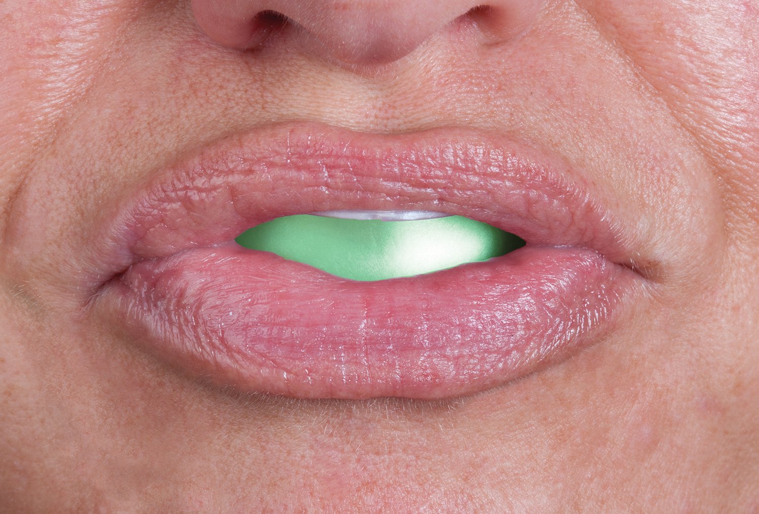 Opalescence Go™ Whitening - quick, simple, convenient!