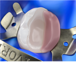 A Multi-Tool for Your Office: J-Temp™ Temporary Resin